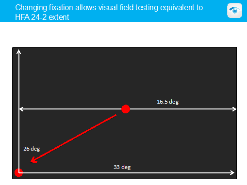 What’s the science behind the MRF visual field test? – Appview Technologies