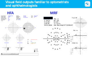 What’s the science behind the MRF visual field test? – Appview Technologies