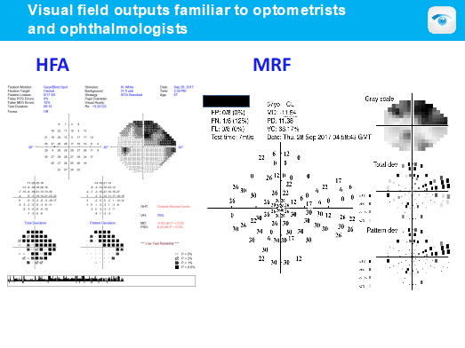 What’s the science behind the MRF visual field test? – Appview Technologies
