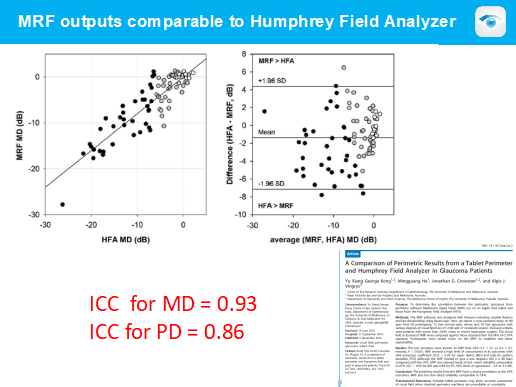 What’s the science behind the MRF visual field test? – Appview Technologies